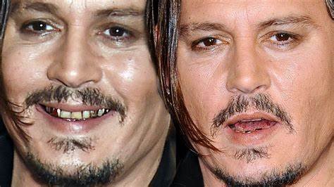 Johnny Depp prefers to keep his 'Rotten' teeth rather than opting for ...